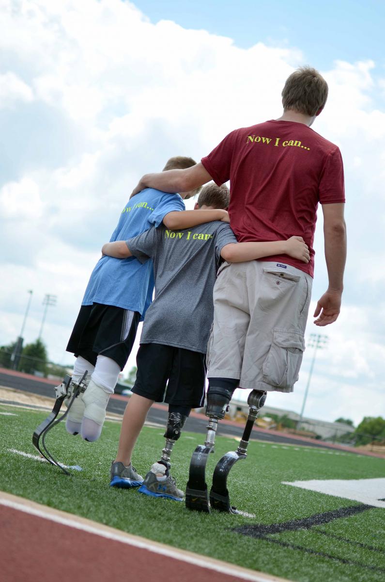 Amputation | Methodist Rehabilitation Center